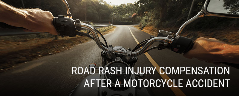 Road Rash Injury Compensation After a Motorcycle Accident